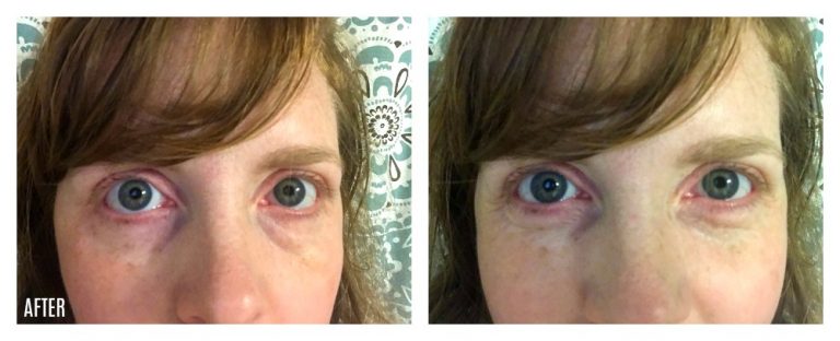 The Ordinary skincare review: We tried it to see if cheap can mean good.